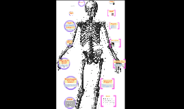 Monosomy 9P by Gabrielle Land on Prezi