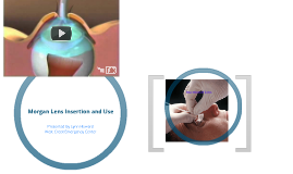 Morgan Lens by Lynn Howard on Prezi