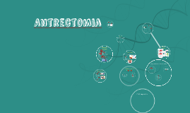 Antrectomia by valeria chavez on Prezi