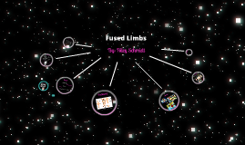 Birth Defect: Fused Limbs by Riley Schmidt on Prezi