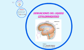 La derivación de líquido cefalorraquídeo (LCR) es by Berenice Meza on Prezi