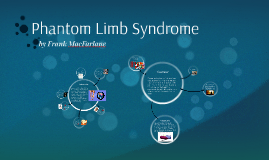 Phantom Limb Syndrome by on Prezi