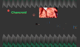 Chancroid by on Prezi