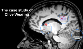 The case study of Clive Wearing by on Prezi