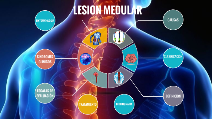 Lesión medular by Valentina Sarria Gomez on Prezi