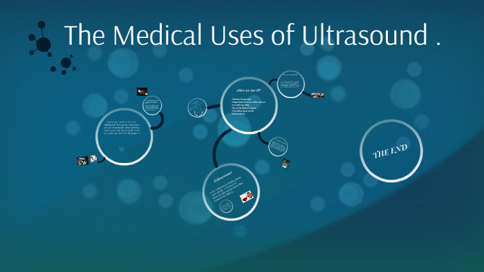 The medical uses of ultrasound by ola dweik on Prezi