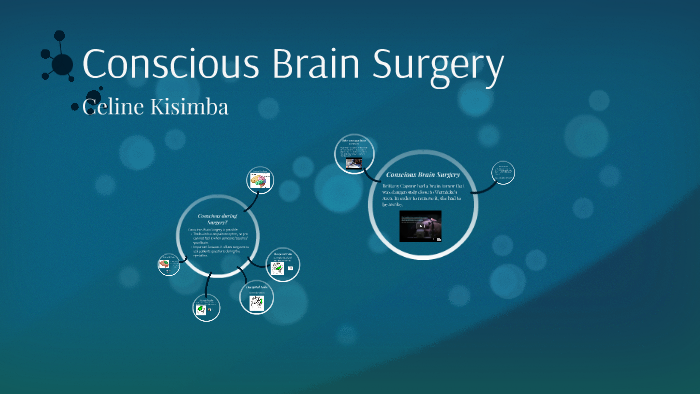 Conscious Brain Surgery by Celine Kisimba on Prezi