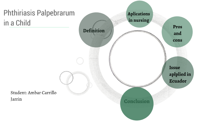 Phthiriasis palpebrarum in a child by A. Alexandra C on Prezi