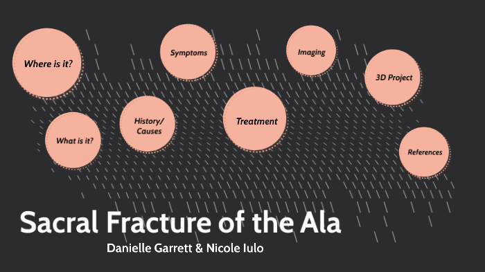 Sacral Fracture of the Ala by Nicole Iulo on Prezi