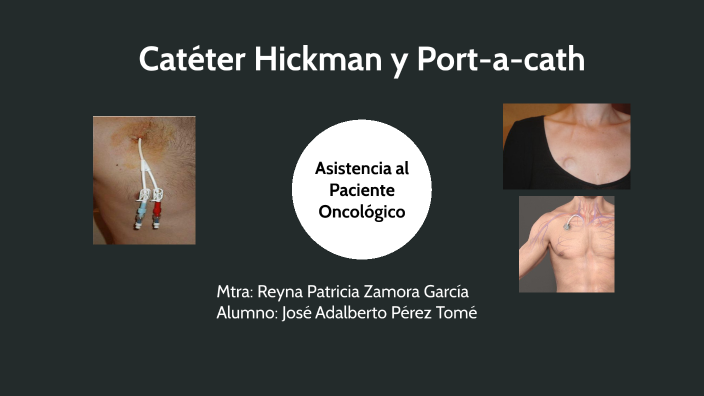 Catéteres Hickman y Port-a-cath by José Adalberto Pérez Tomé on Prezi
