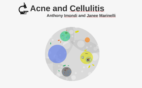 Acne and Cellulitis by janee m on Prezi