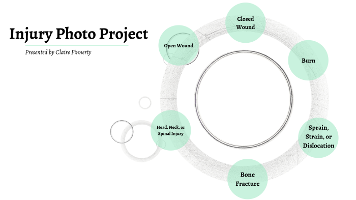 Injury Photo Project by claire finnerty on Prezi