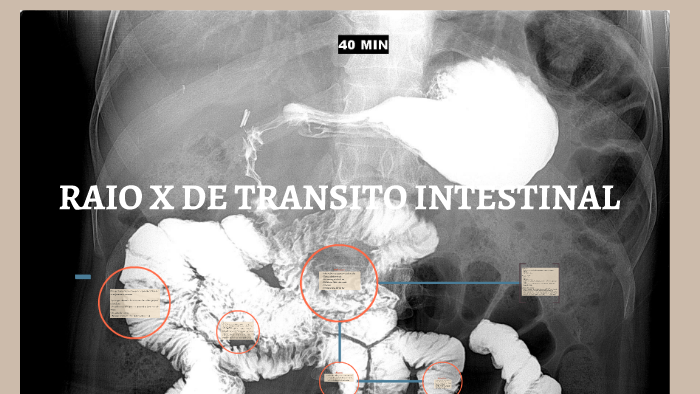 RAIO X DE TRANSITO INTESTINAL by paola borella on Prezi