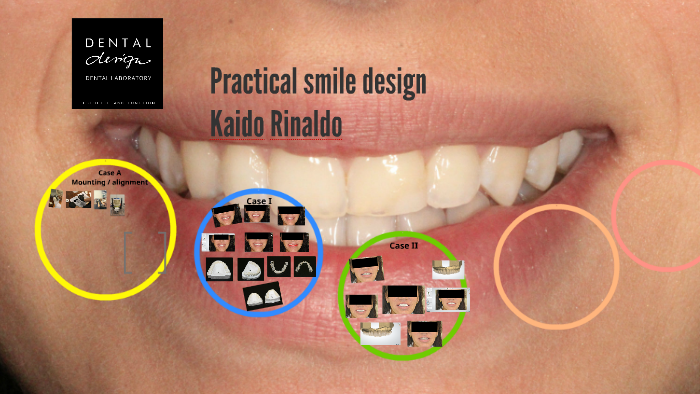 Practical smile design by on Prezi