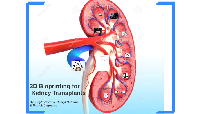 3D Bioprinting for Kidney Transplants by Kayla Garrow