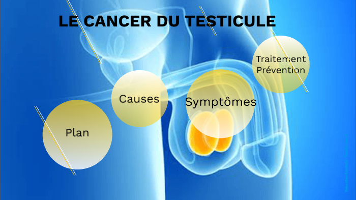 CANCER DU TESTICULE by Charles Le Bail on Prezi