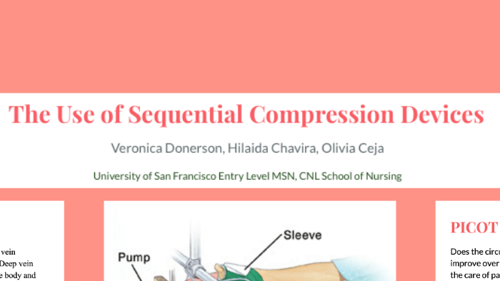 The Use of Sequential Compression Devices by Olivia Eyebrow on Prezi