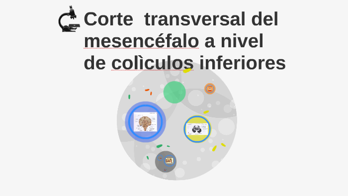 Corte transverse del mescensefalo a nivel de colìculos infe by diana ...