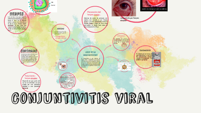 Conjuntivitis Viral By Luisa Ulloa On Prezi