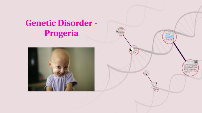 Genetic Disorder - Progeria by Mariah james on Prezi