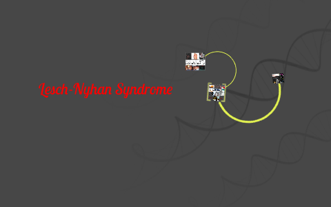 Lesch-Nyhan Syndrome by Ezza Ahmed on Prezi