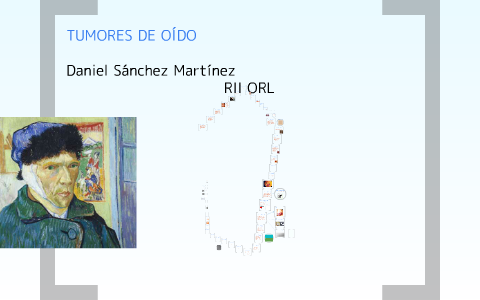 tumores de oído by daniel sanchez on Prezi