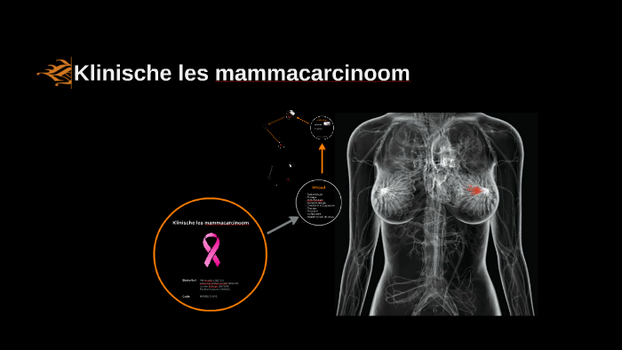 Klinische les mammacarcinoom by Rik Andela on Prezi