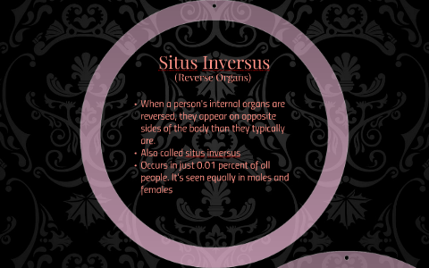 When a person's internal organs are reversed, they appear on by Jenna ...