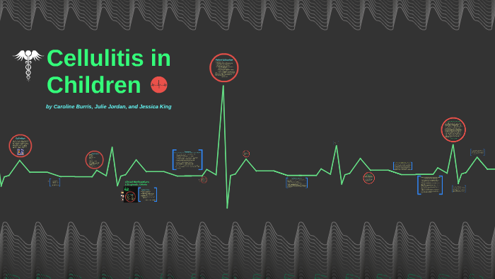 Cellulitis in Children by Jessica Hughes