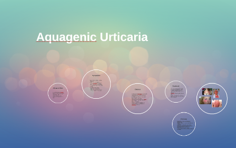 Aquagenic Urticaria – Allergy to Water by Stefanie Rankin on Prezi