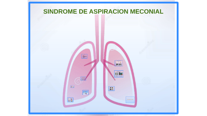 Sindrome De Aspiracion Meconial - vrogue.co Sindrome De Aspiracion Meconial - vrogue.co