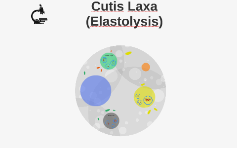Cutis Laxa by Molly Miller on Prezi