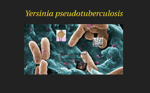 Yersinia pseudotuberculosis by on Prezi