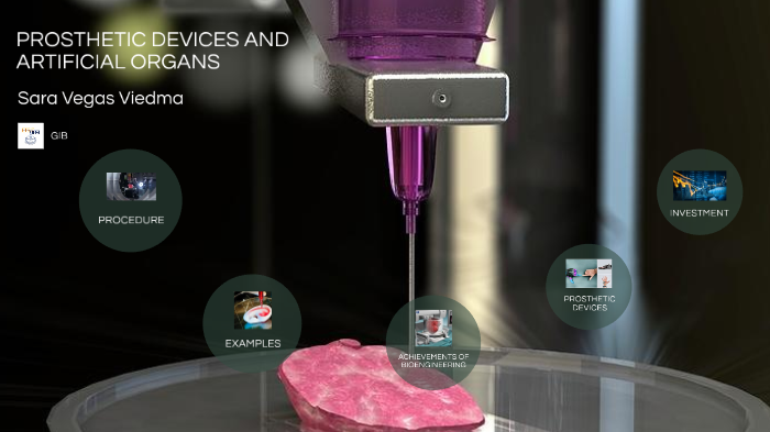 PROSTHETIC DEVICES AND ARTIFICIAL ORGANS by Sara Vegas on Prezi