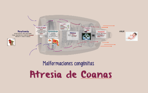 Atresia de Coanas by Mery Hernandez on Prezi