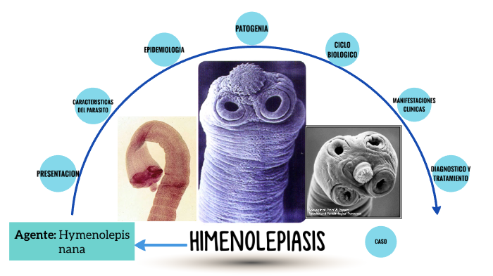 HIMENOLEPIASIS by Paula Cuenca on Prezi