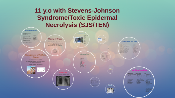 11 yo. with Stevens-Johnson Syndrome/Toxic Epidermal Necroly by Eva ...