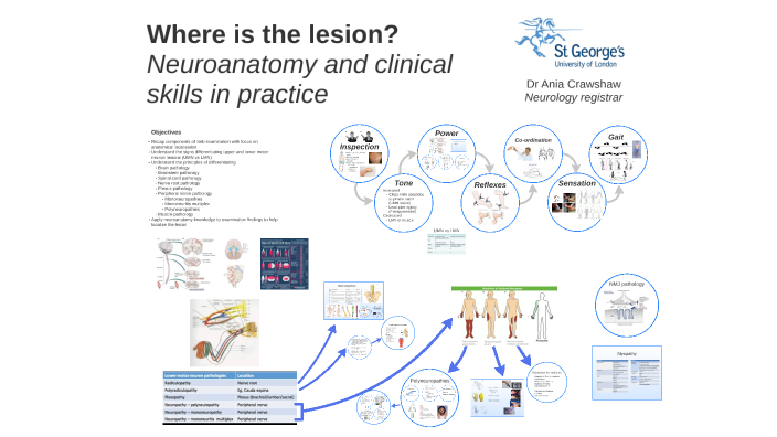 Where is the lesion? Neuroanatomy and clinical signs in practice by ...