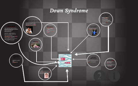 Down Syndrome by Sarah Eberhardt on Prezi