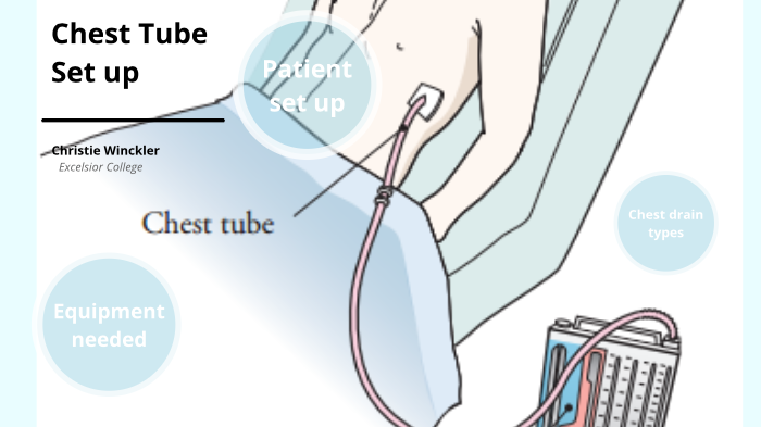 Chest tube set up by christie winckler on Prezi