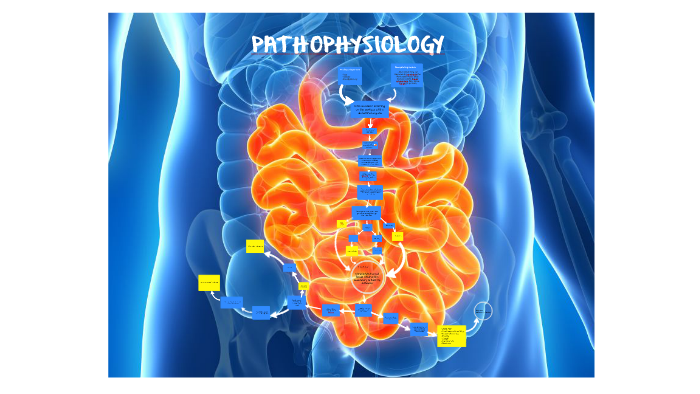 Pathophysiology of Complete Mechanical Bowel Obstruction with ...