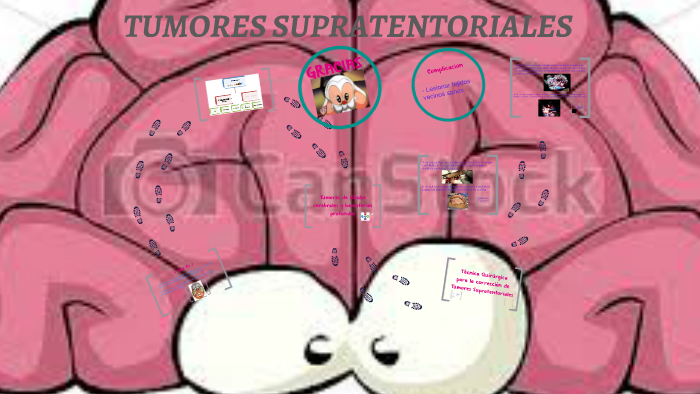 TUMORES SUPRATENTORIALES by Eli Cortés Pedreros on Prezi