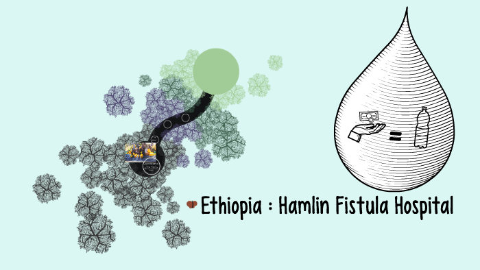 Ethiopia : Hamlin Fistula Hospital by Emma Nardozi on Prezi