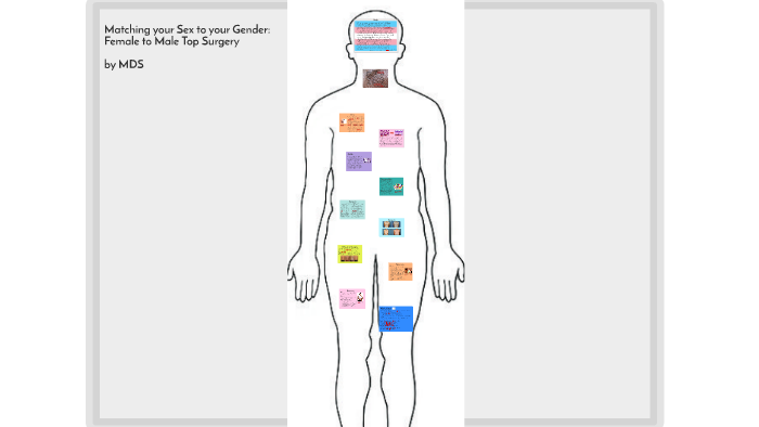 TOP Surgery by MDS on Prezi