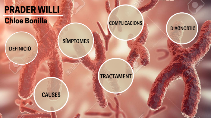 PRADER WILLI by Chloe Bonilla on Prezi