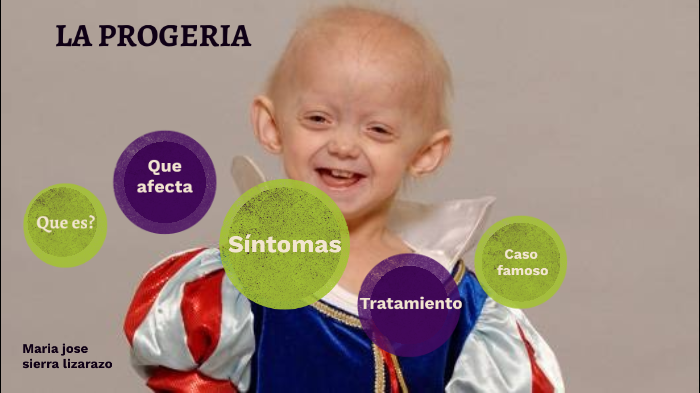 La progeria by maria sierra lizarazo on Prezi