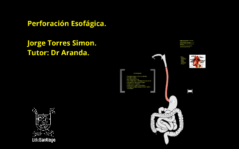 Perforación Esofágica by Ana María Yáñez on Prezi