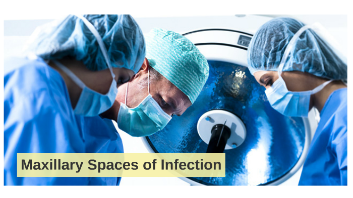 Maxillary Spaces of Infection by Lubna Elsayed on Prezi