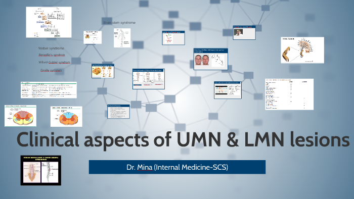 Clinical aspects of UMN & LMN lesions by mina alemam on Prezi