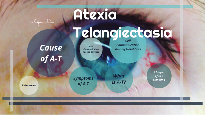 Alexia Telangiectasia by Kejun Liu on Prezi